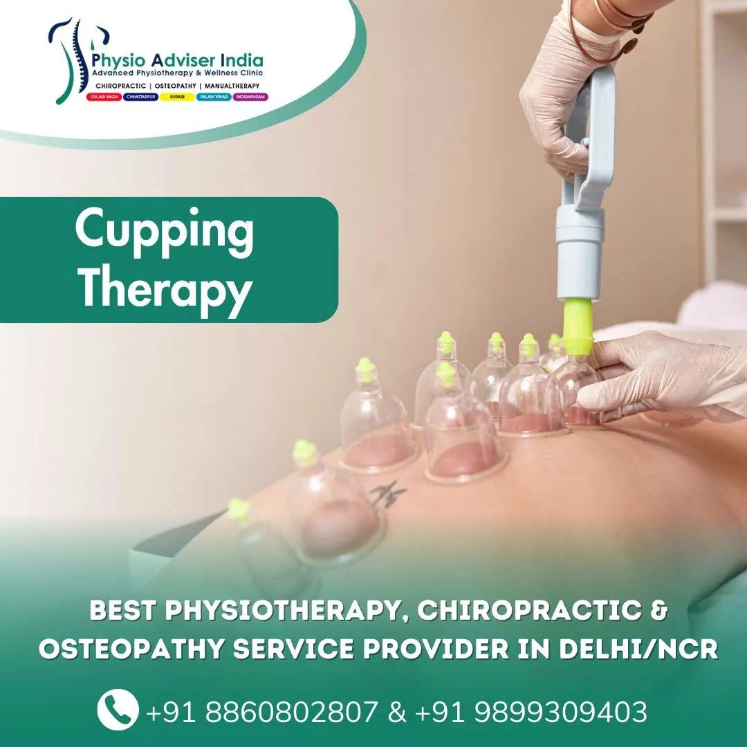Cupping Therapy Treatment in Delhi & NCR - Physio Adviser India