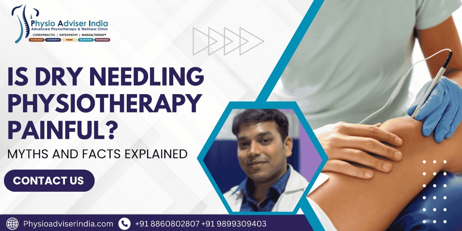 Is Dry Needling Physiotherapy Painful? Myths and Facts Explained ...