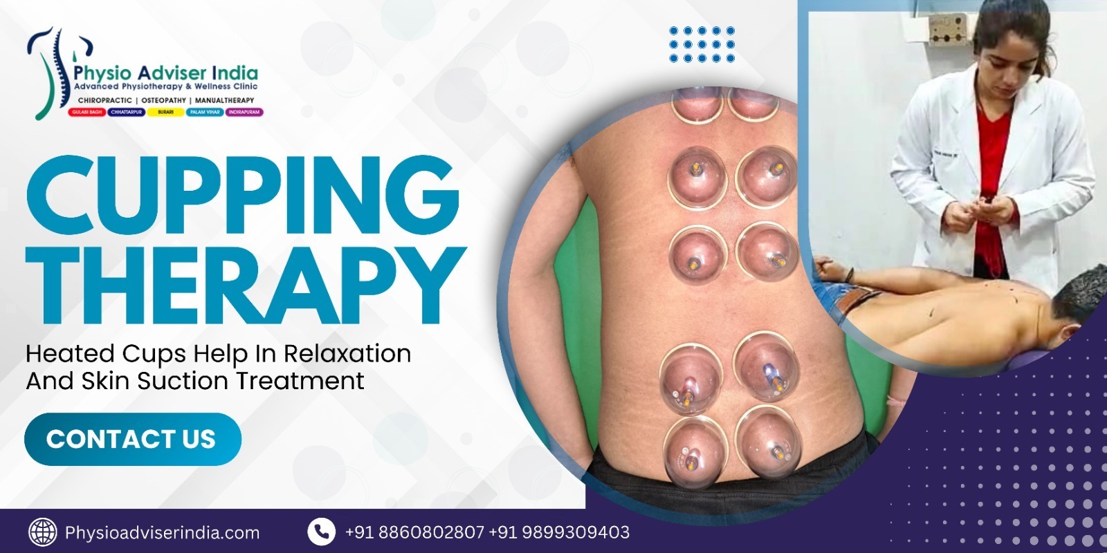 Cupping Therapy - Heated Cups Help In Relaxation And Skin Suction ...